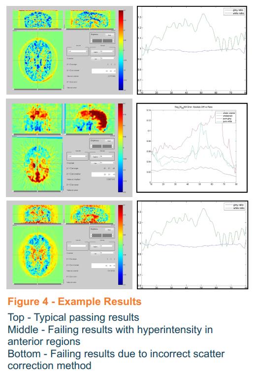 Hoffman脑模型是什么？飞勒原创科普来了