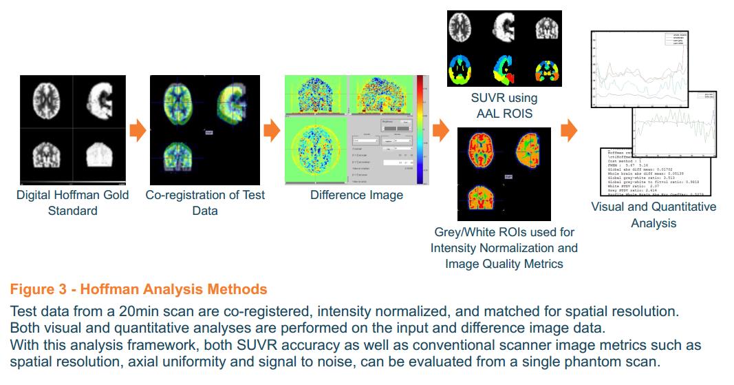 Hoffman脑模型是什么？飞勒原创科普来了